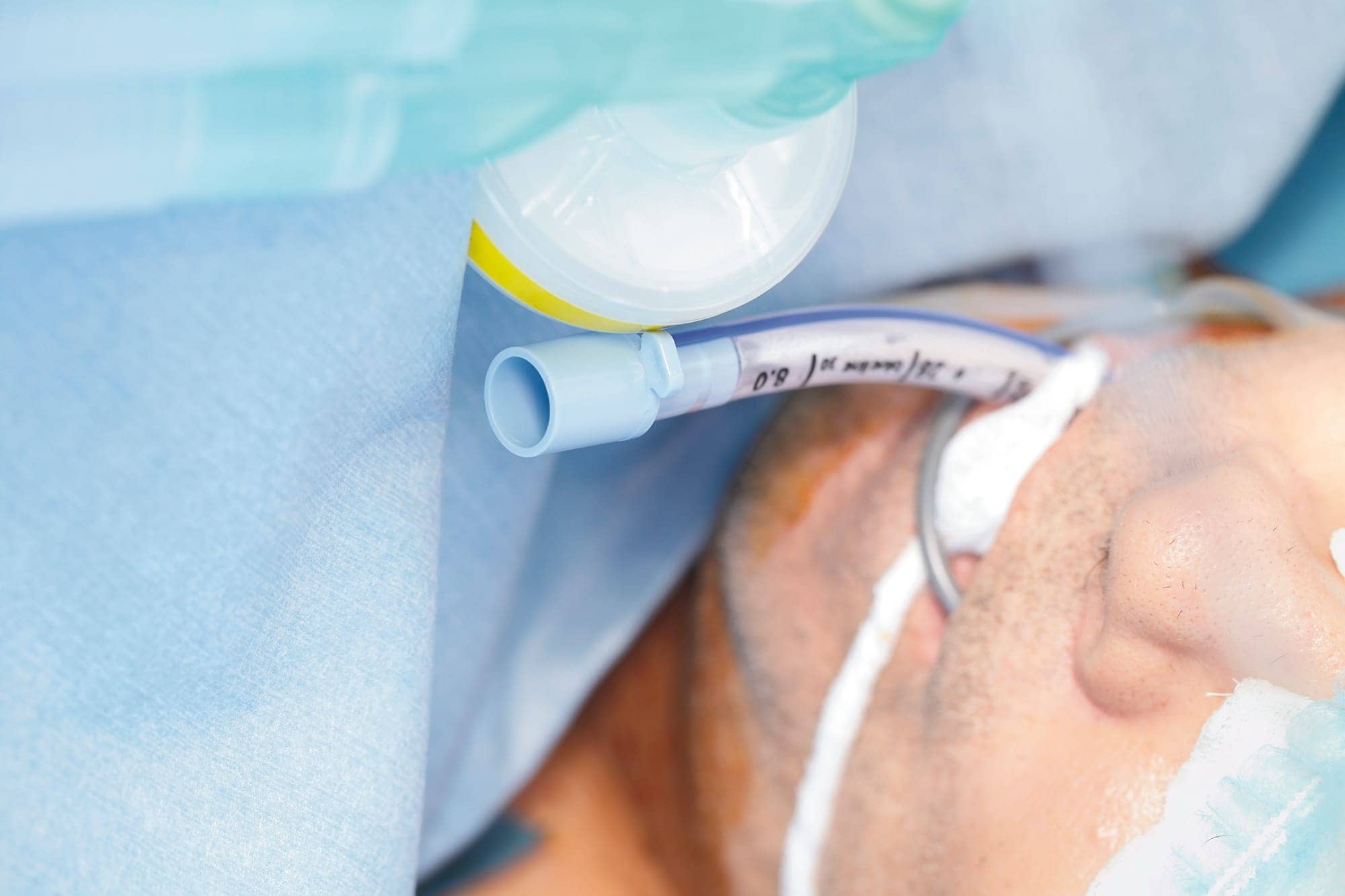 Awake Prone Positioning and COVID-19 Intubation Rates | Respiratory Therapy