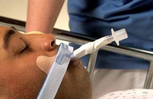 Products 2017 | Airway Management | RT