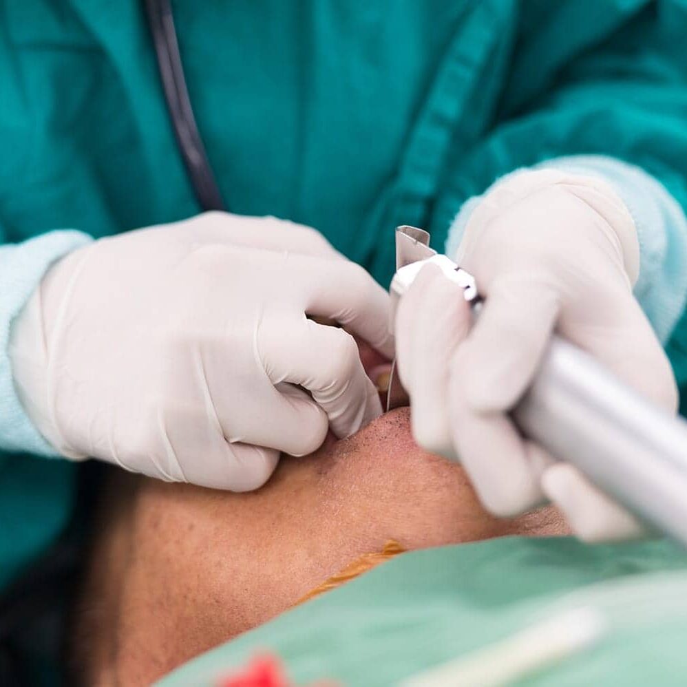 Endotracheal Intubation Procedure Intubation Causes Symptoms