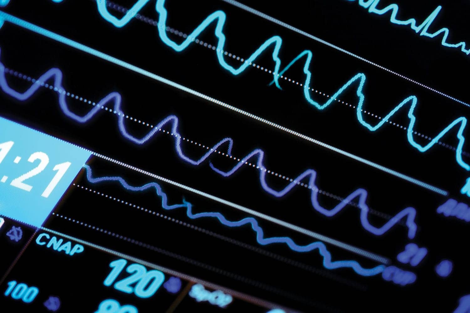 A New Community for Patient Monitoring | RT