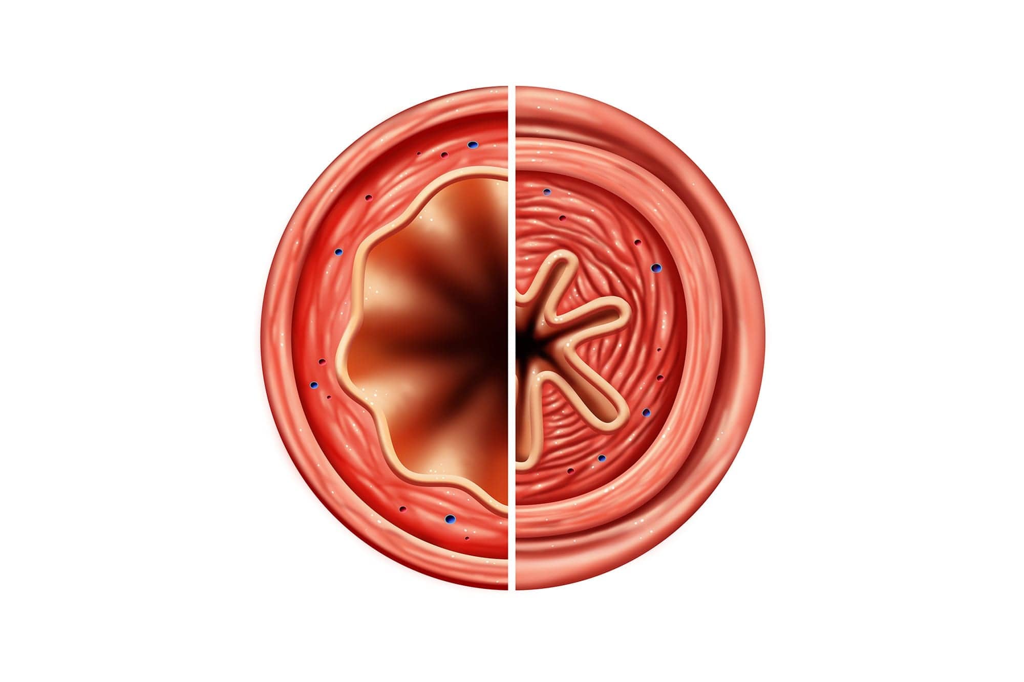 Endocannabinoids Dilate the Airway | Respiratory Therapy