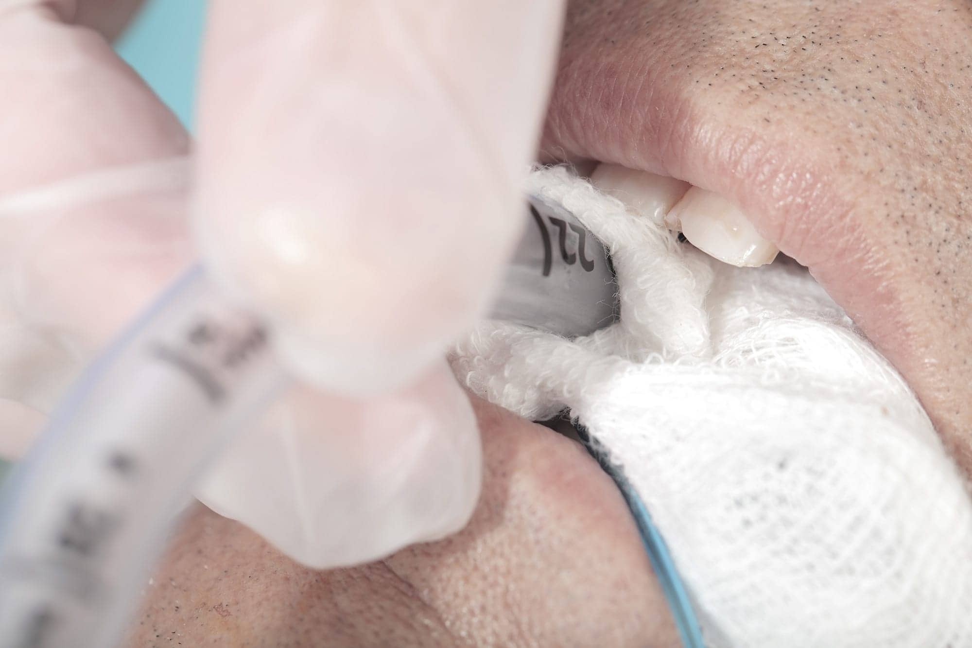 Airway Management in the ICU | RT