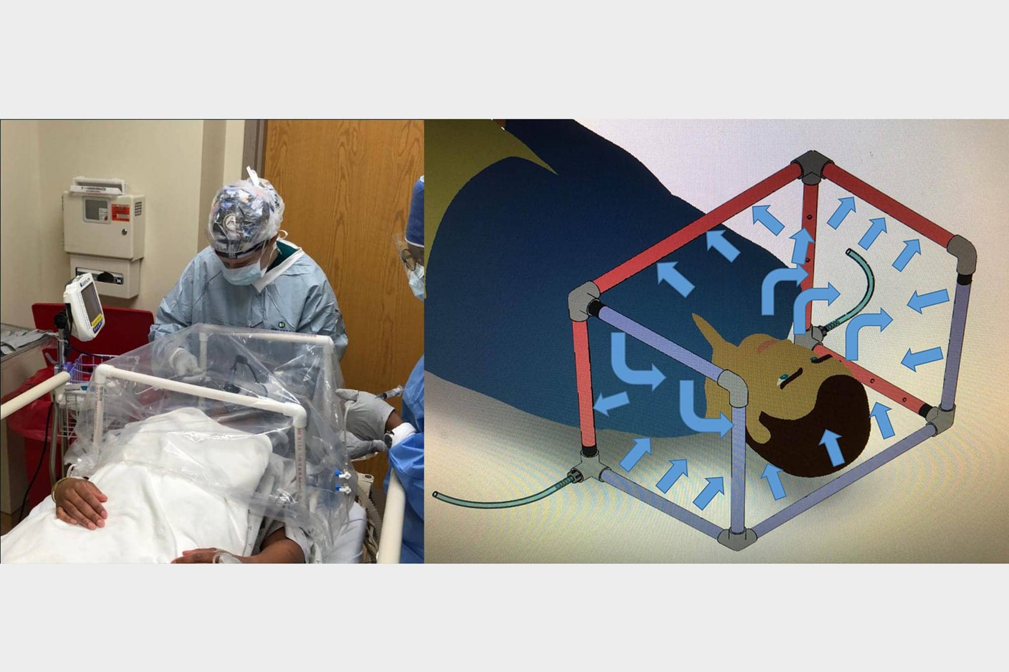 FDA Authorizes Airway Isolation Chamber Developed by Army Doctors ...