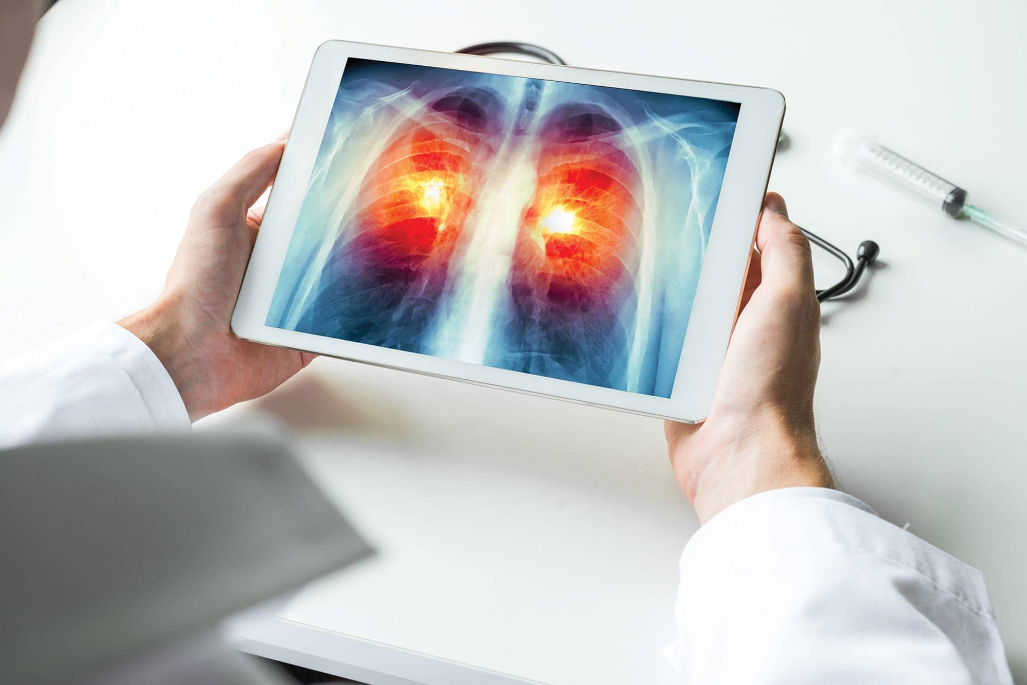 New Lung Cancer Screening Guidelines Reduce Disparity | Respiratory Therapy