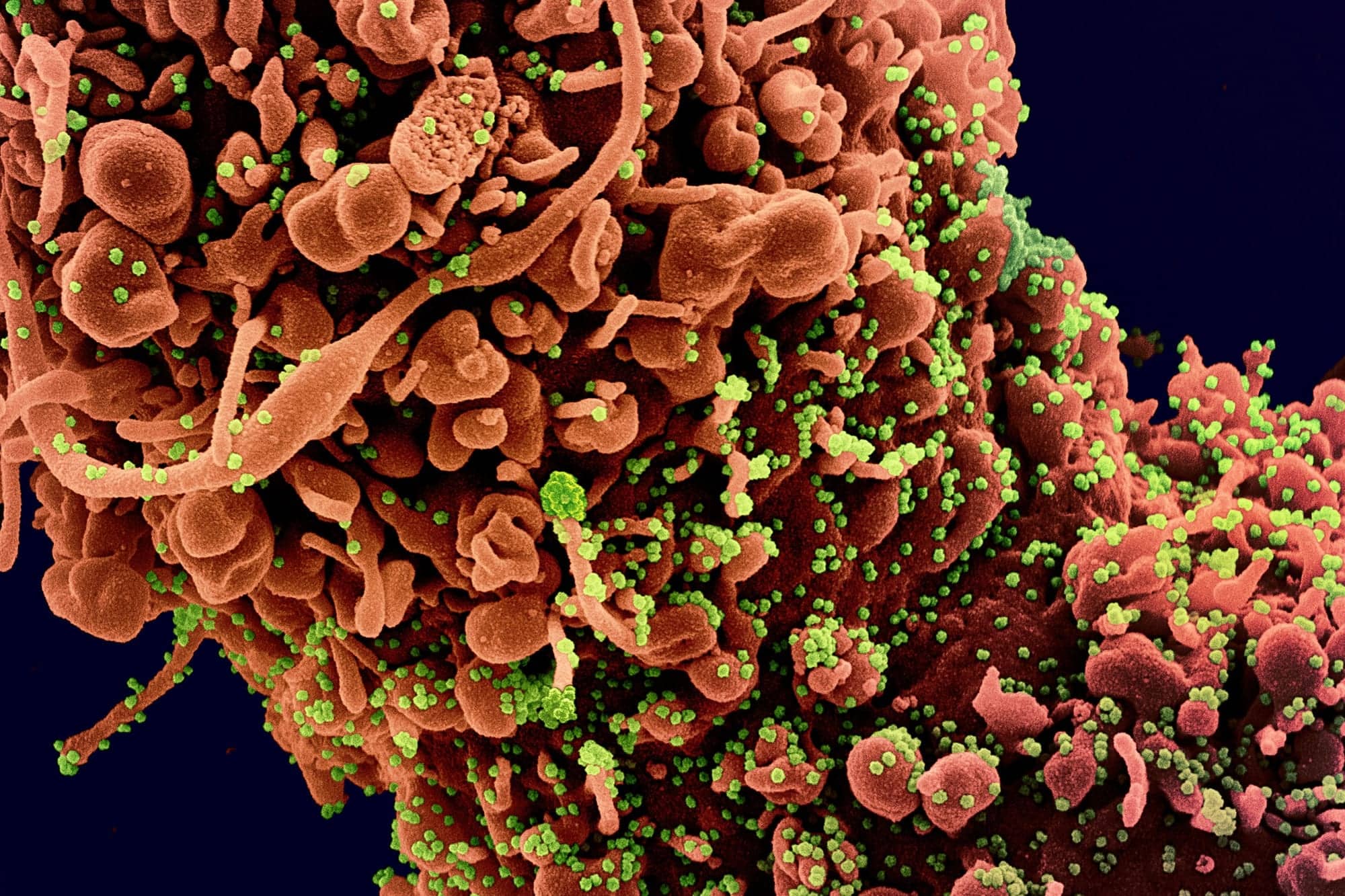 Siemens Healthineers CliniTest Antigen COVID Test Available in US ...