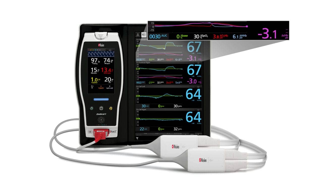 Patient Monitoring Archives | Respiratory Therapy