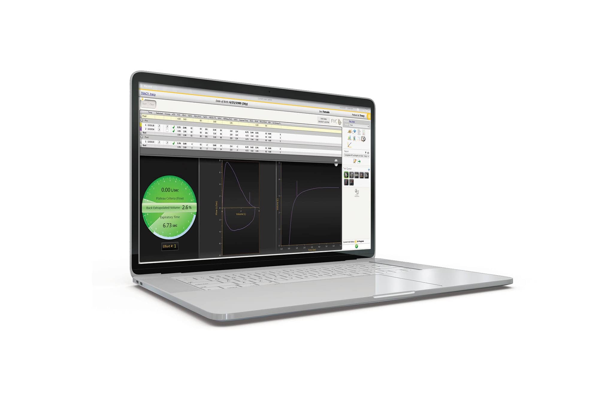 MGC Diagnostics Introduces Ascent Cardiorespiratory Diagnostic Software ...