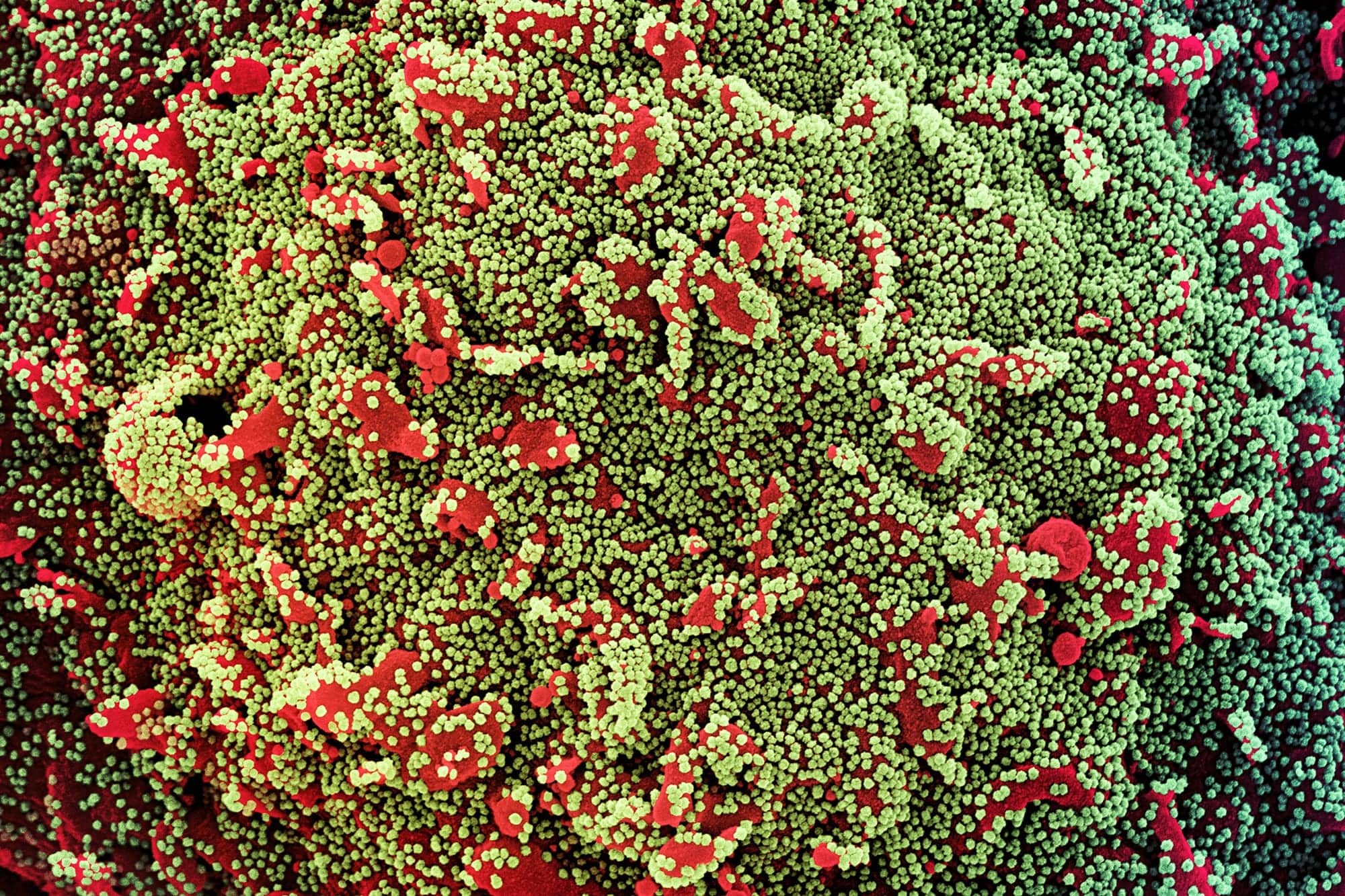 FDA Revokes EUA for Monoclonal Antibody Bamlanivimab | Respiratory Therapy