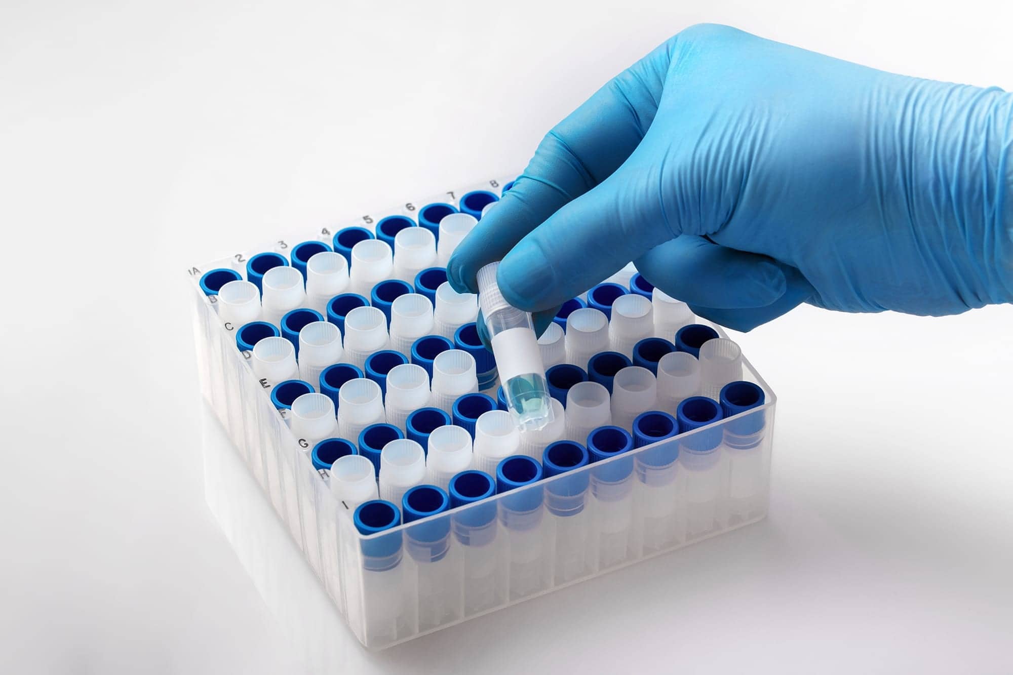 COVID-19 Vaccines Not Linked to Miscarriage | RT