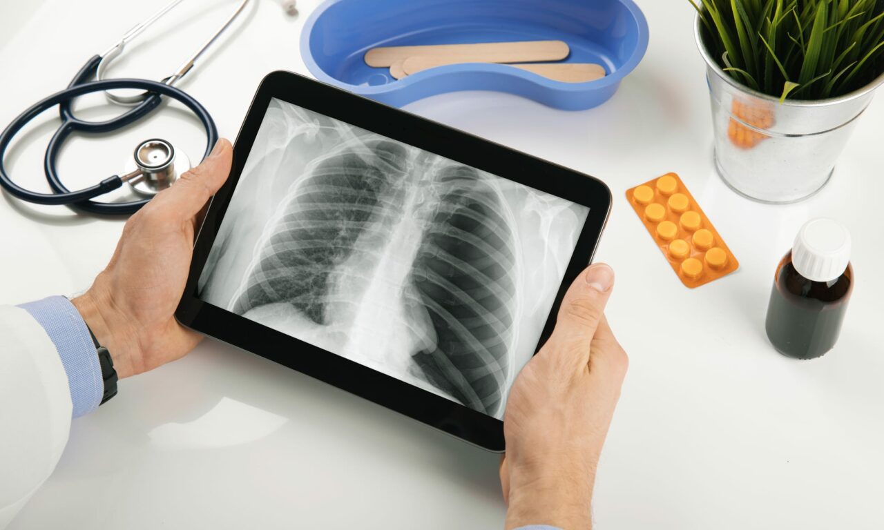 Pulmonary Fibrosis Archives | Page 2 of 64 | Respiratory Therapy