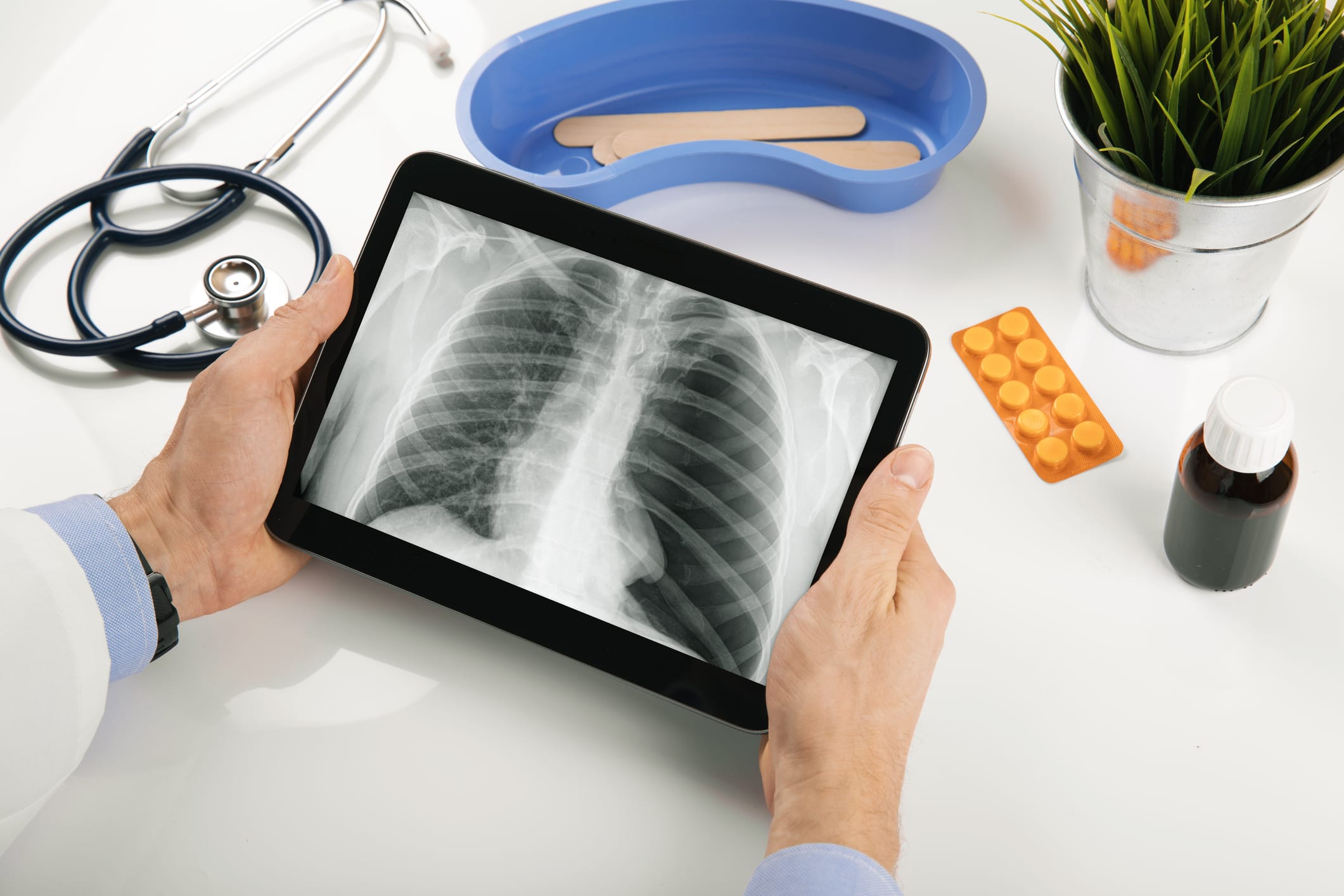 Pilot Study Explores Early Detection of IPF Using X-Ray and AI