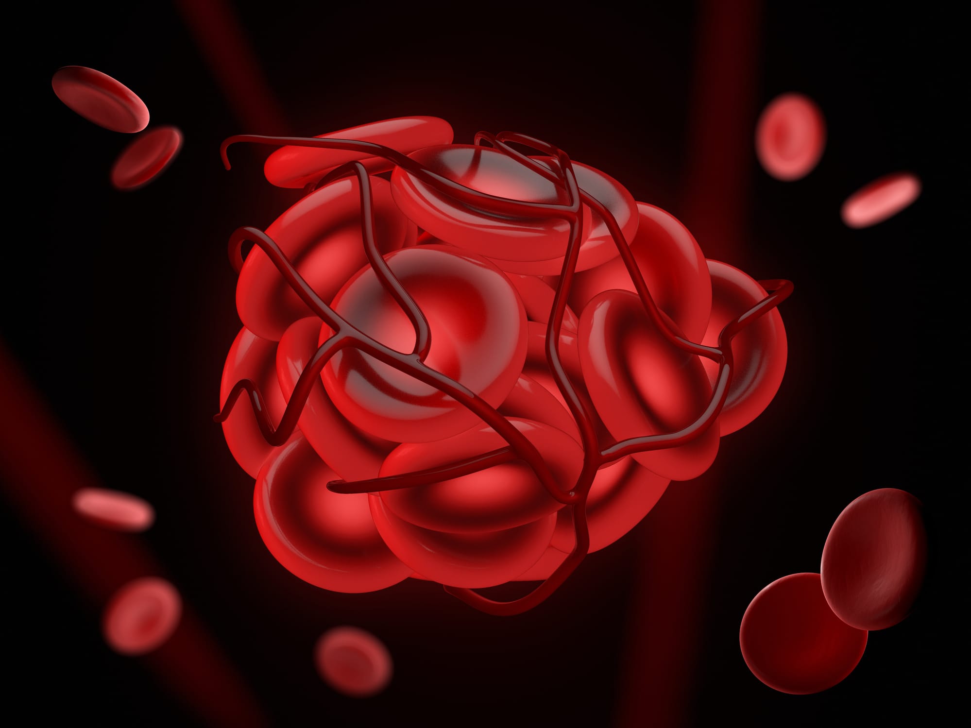 Coagulation Testing Guidance for Patients on Blood Thinners | RT