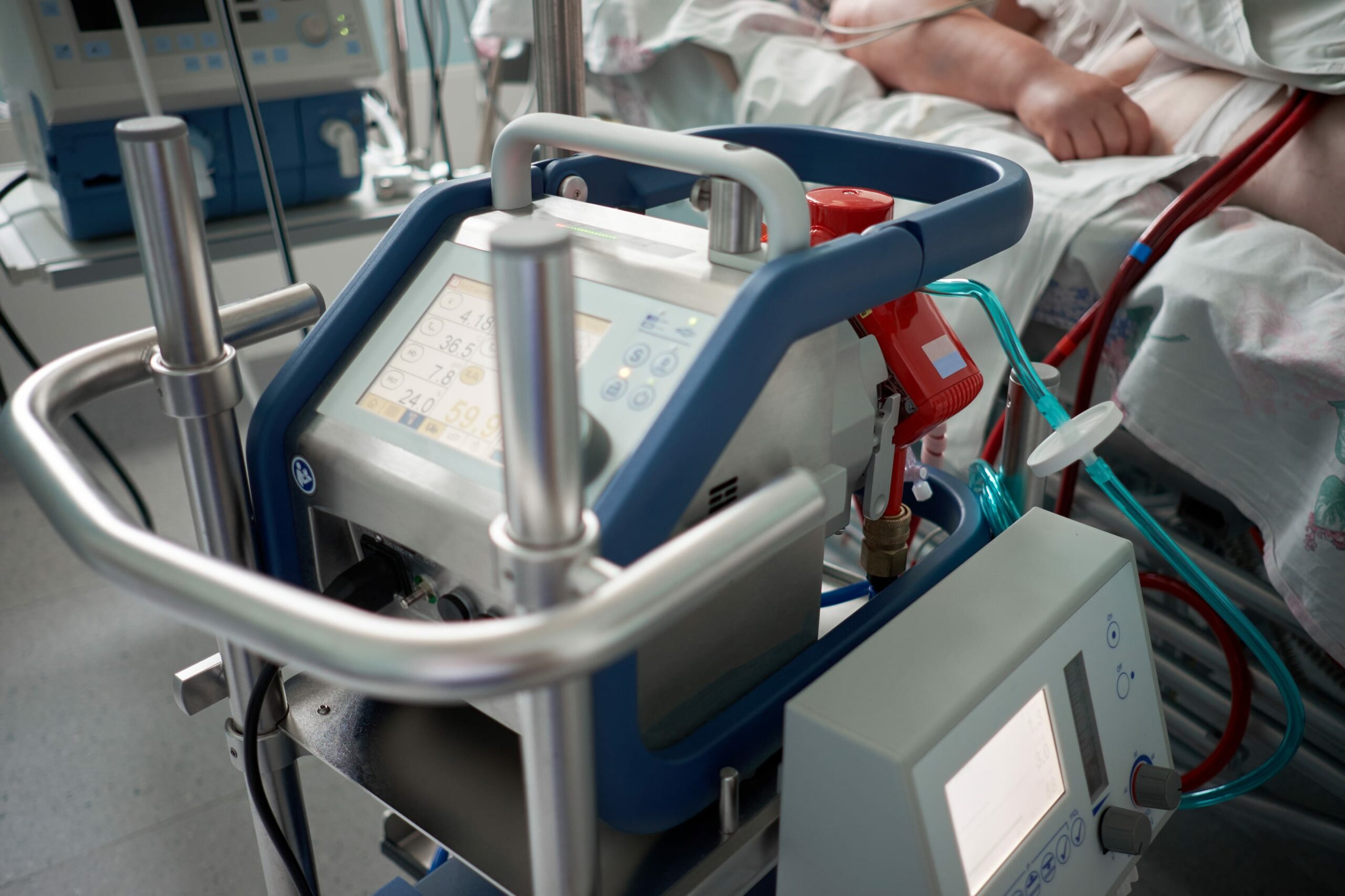 Obesity May Not Hinder ECMO Treatment in ARDS Patients | Respiratory ...