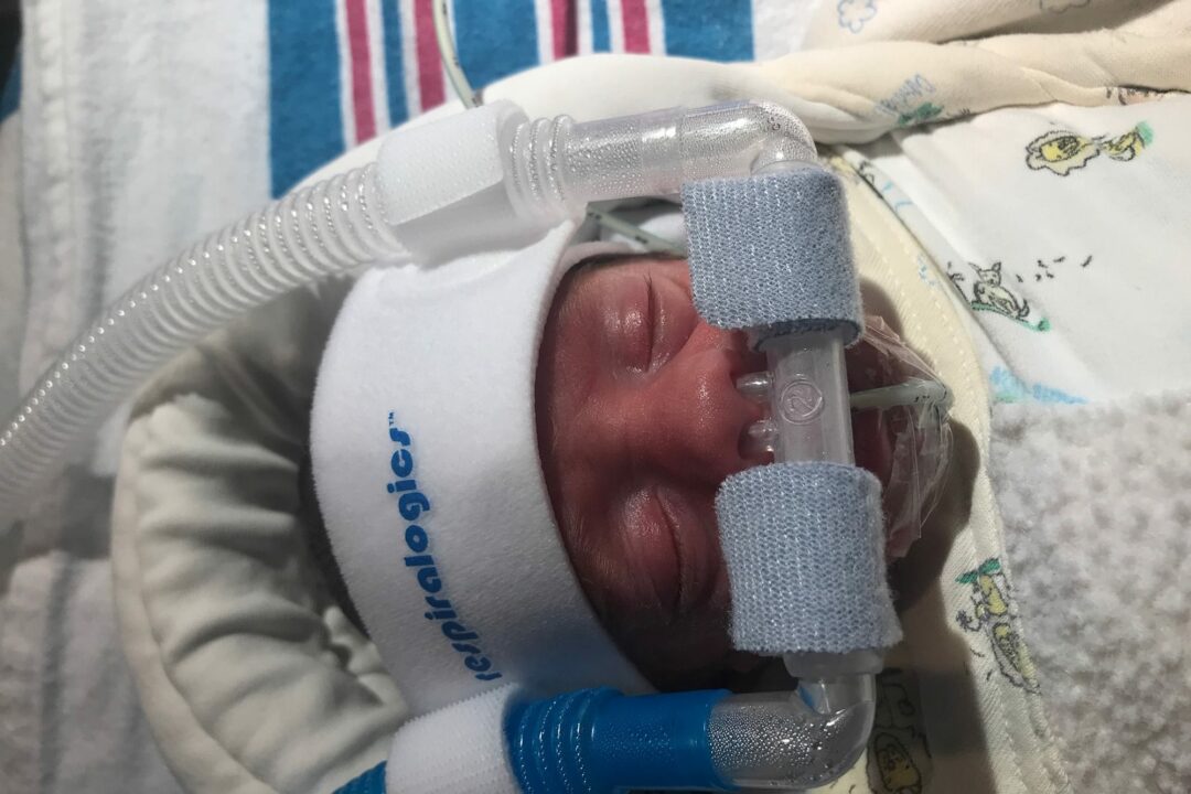 Bubble CPAP a Noninvasive Lifeline for Infants | RT