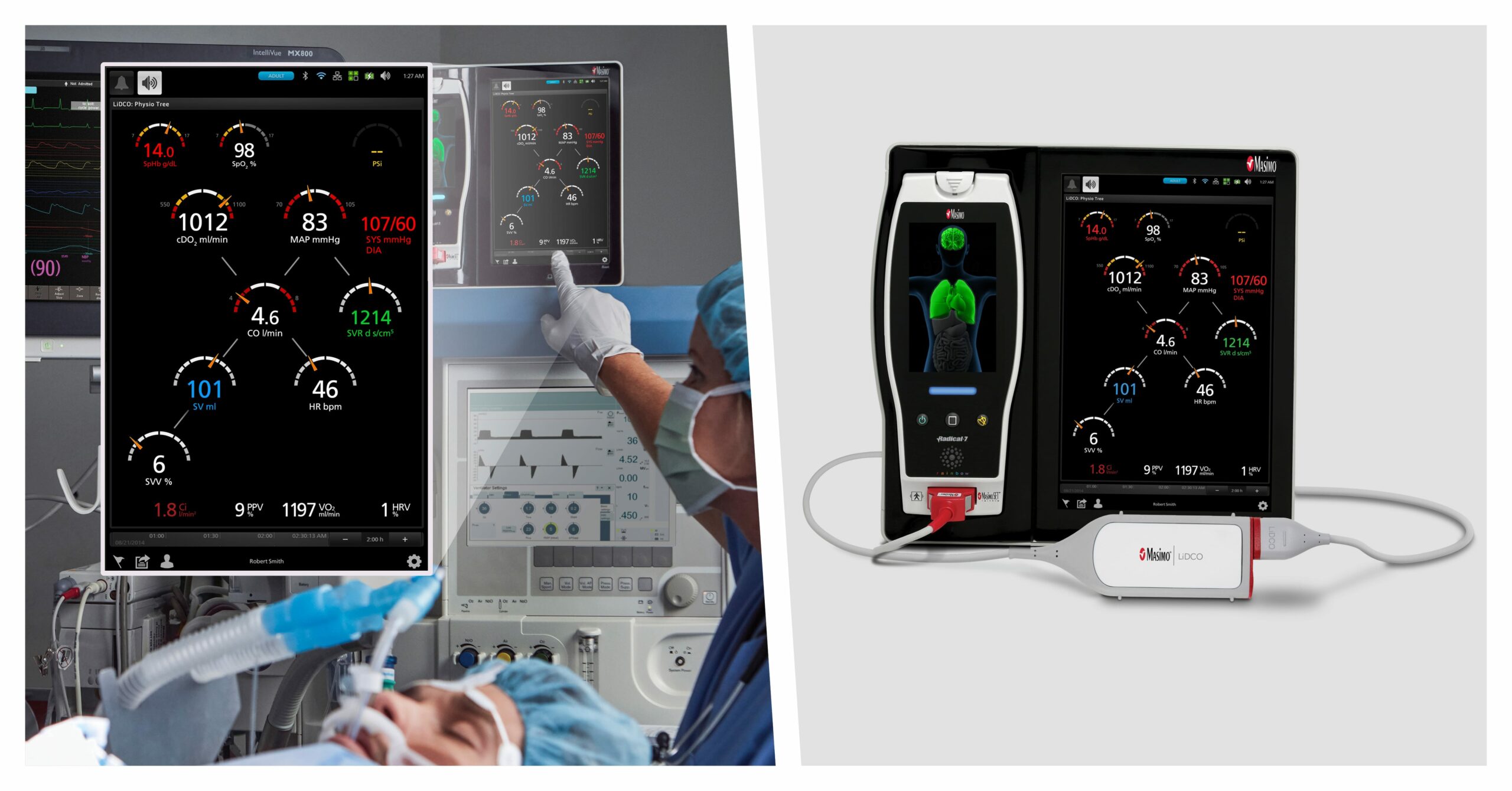 Masimo Gets CE Mark for LiDCO for Hemodynamic Monitoring