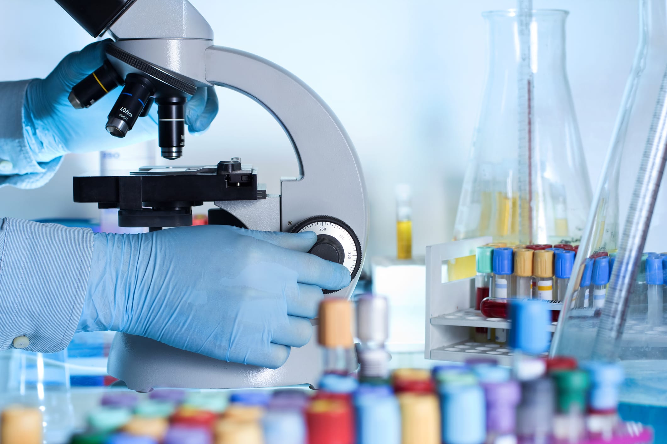 Lab-Created Phlegm May Enhance Cystic Fibrosis Understanding ...