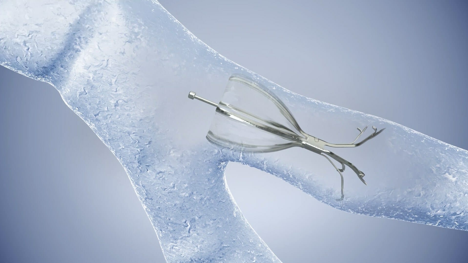 Valve System Shows Sustained Gains in Severe Emphysema | Respiratory ...