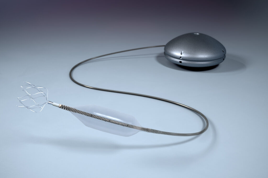 Aria CV Implants First Patient with Pulmonary Hypertension System