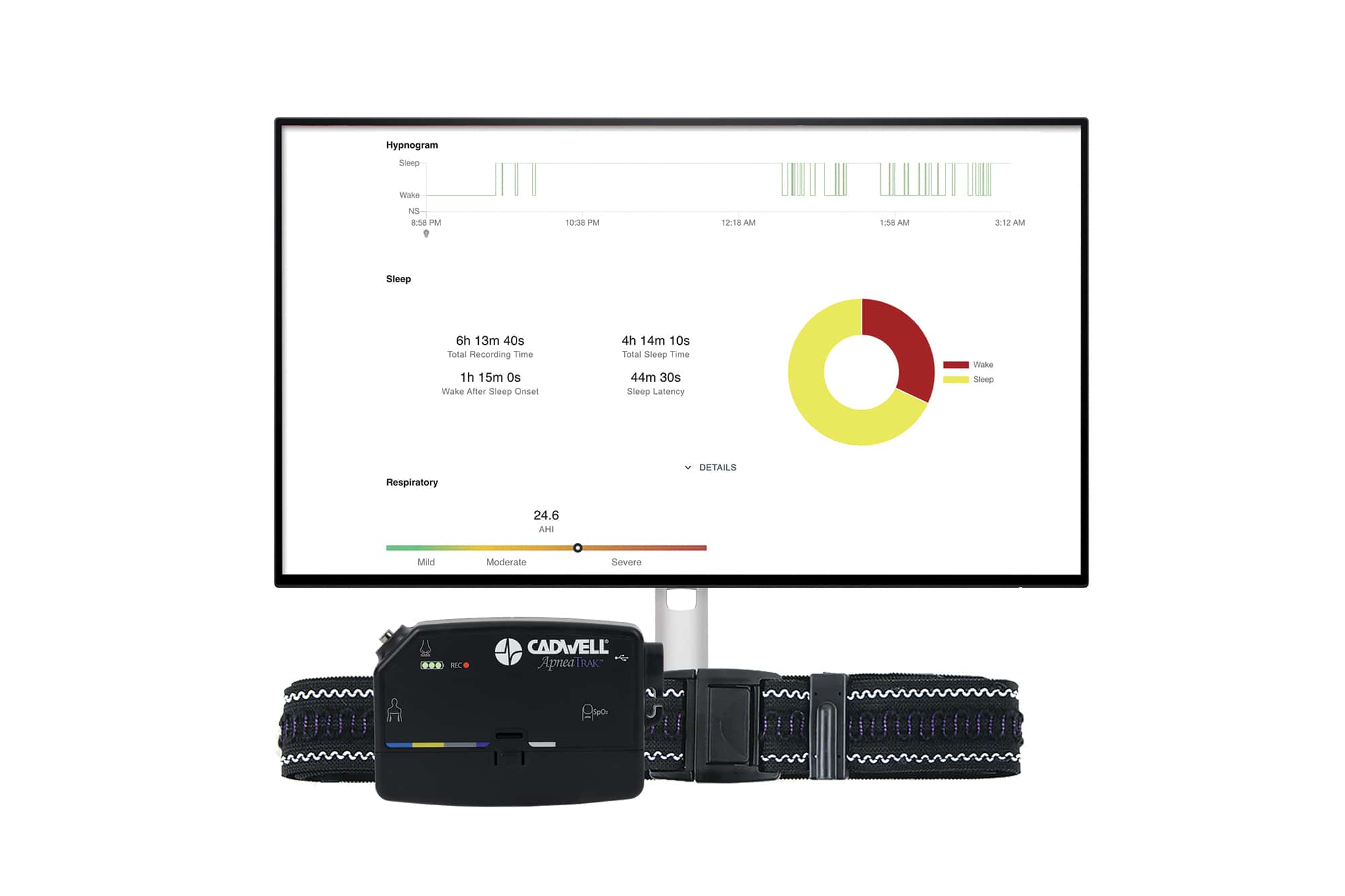Products 2024: Positive Airway Pressure & Sleep Therapy | RT