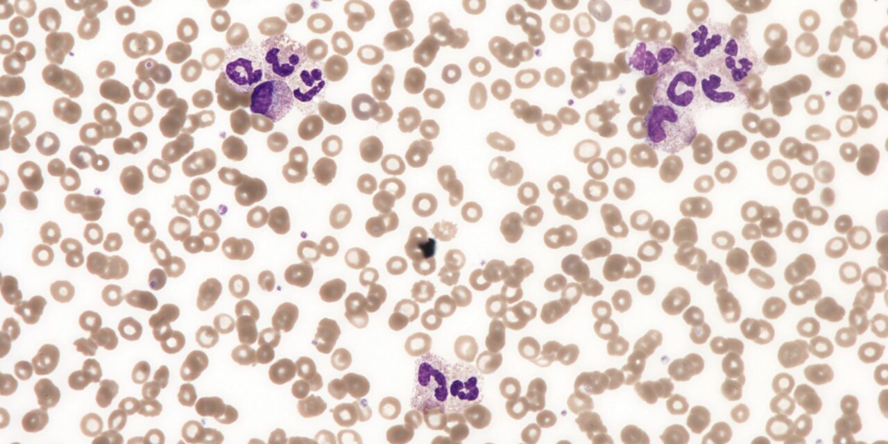 NIH Grant Funds Research into Neutrophils' Role in Lung Health ...