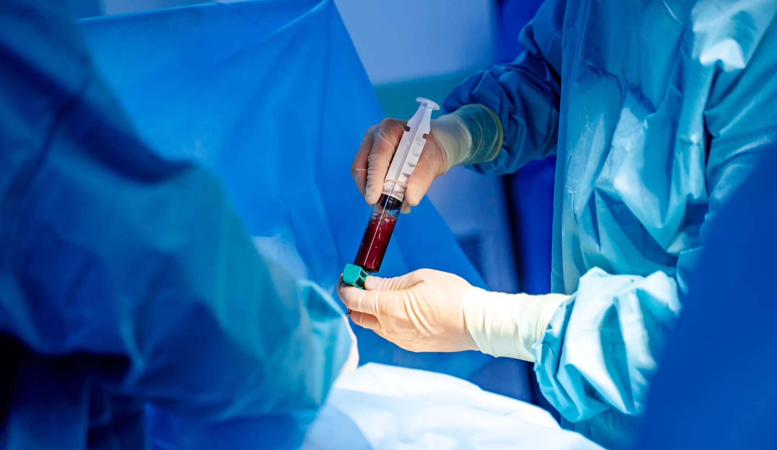 Milder Blood Stem Cell Transplants Preserves Lung Function in Sickle ...