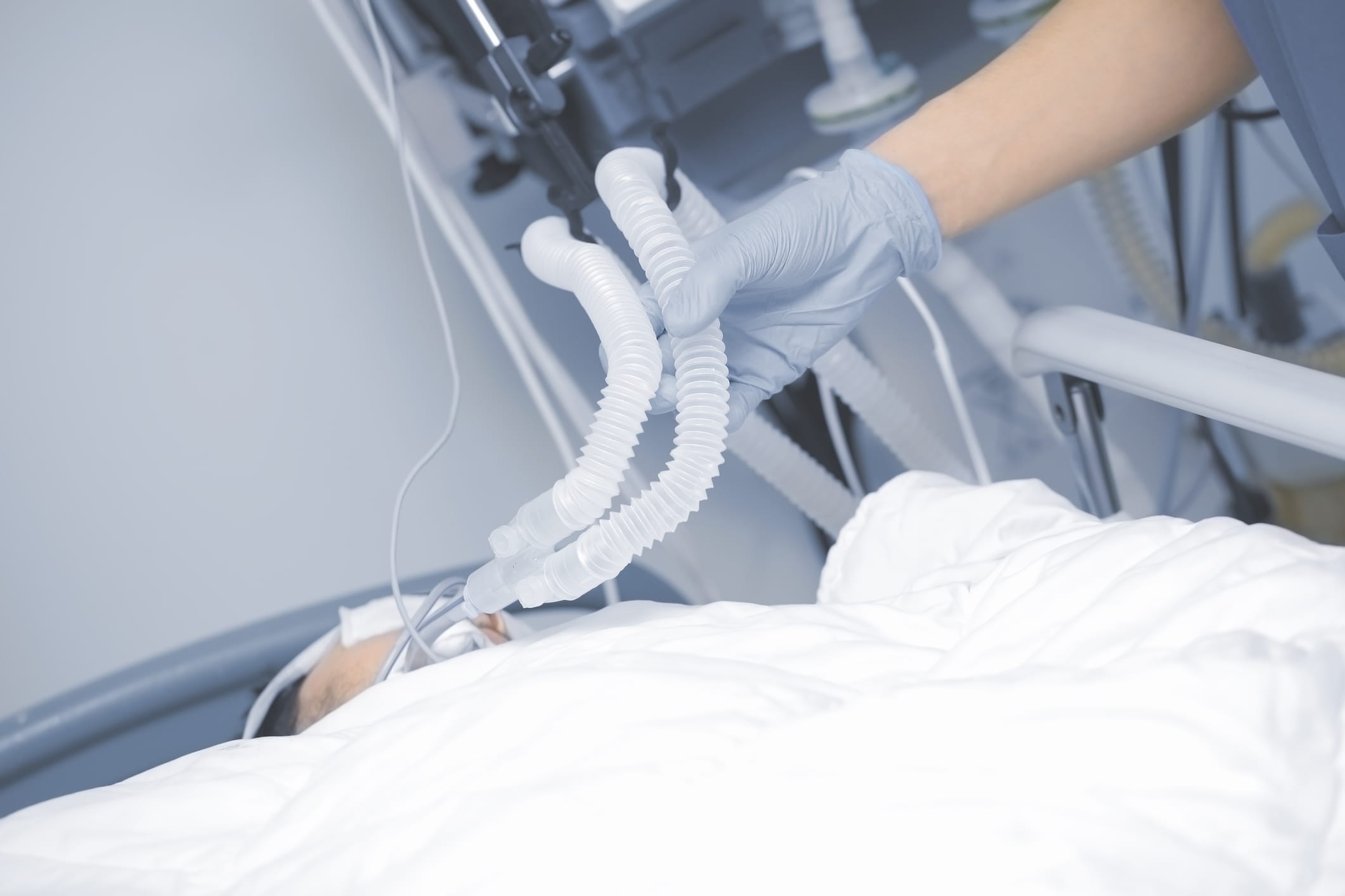 Study Testing ECCO2 Removal for Respiratory Failure | RT