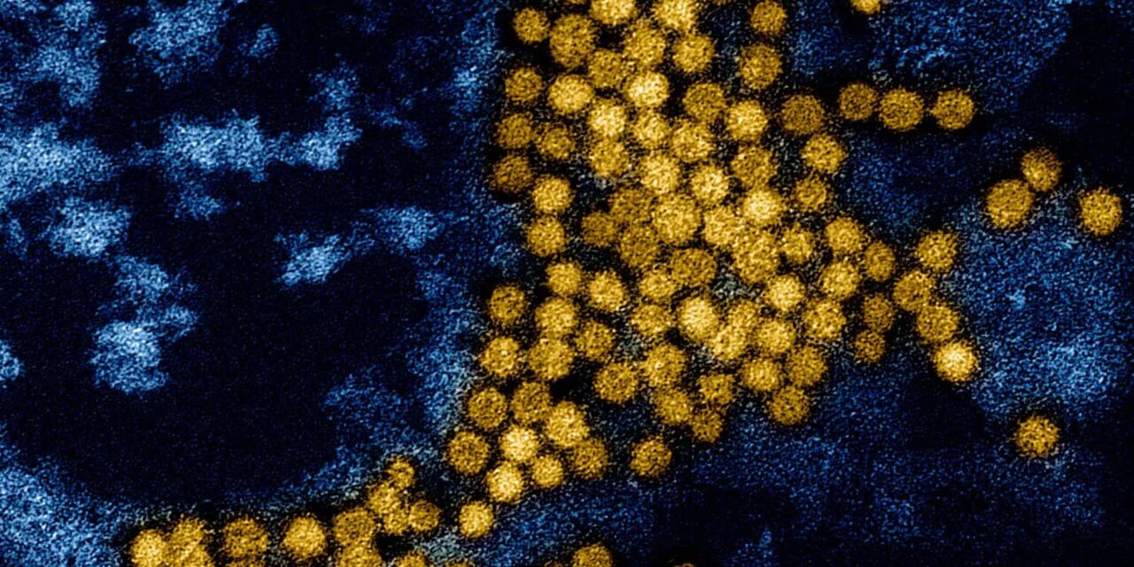 Roche Launches New Respiratory Pathogen Test in CE Markets | RT