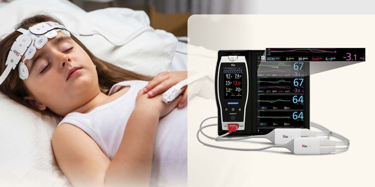 FDA Expands Clearance for Masimo O3 Regional Oximetry | RT