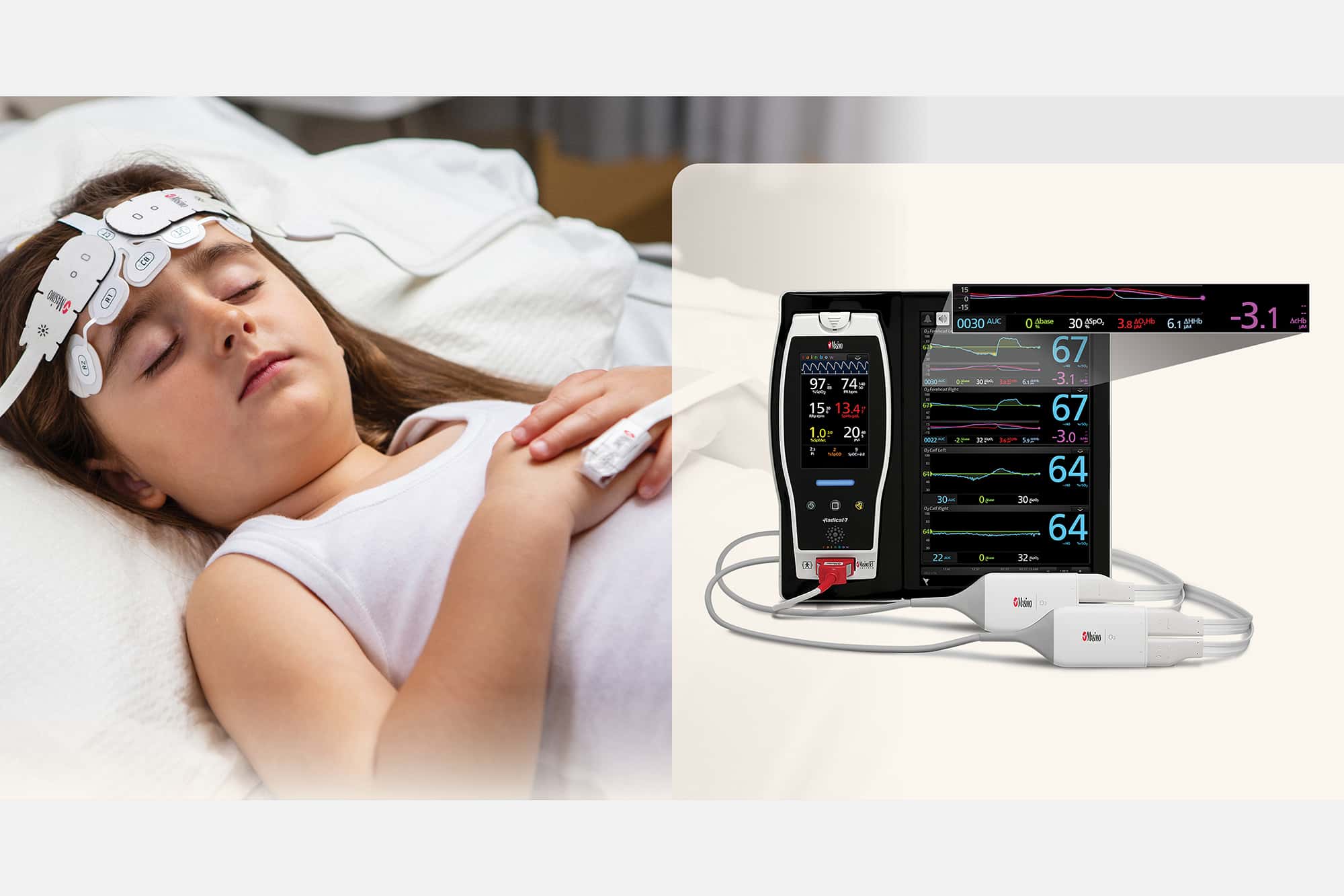 FDA Expands Clearance for Masimo O3 Regional Oximetry | RT