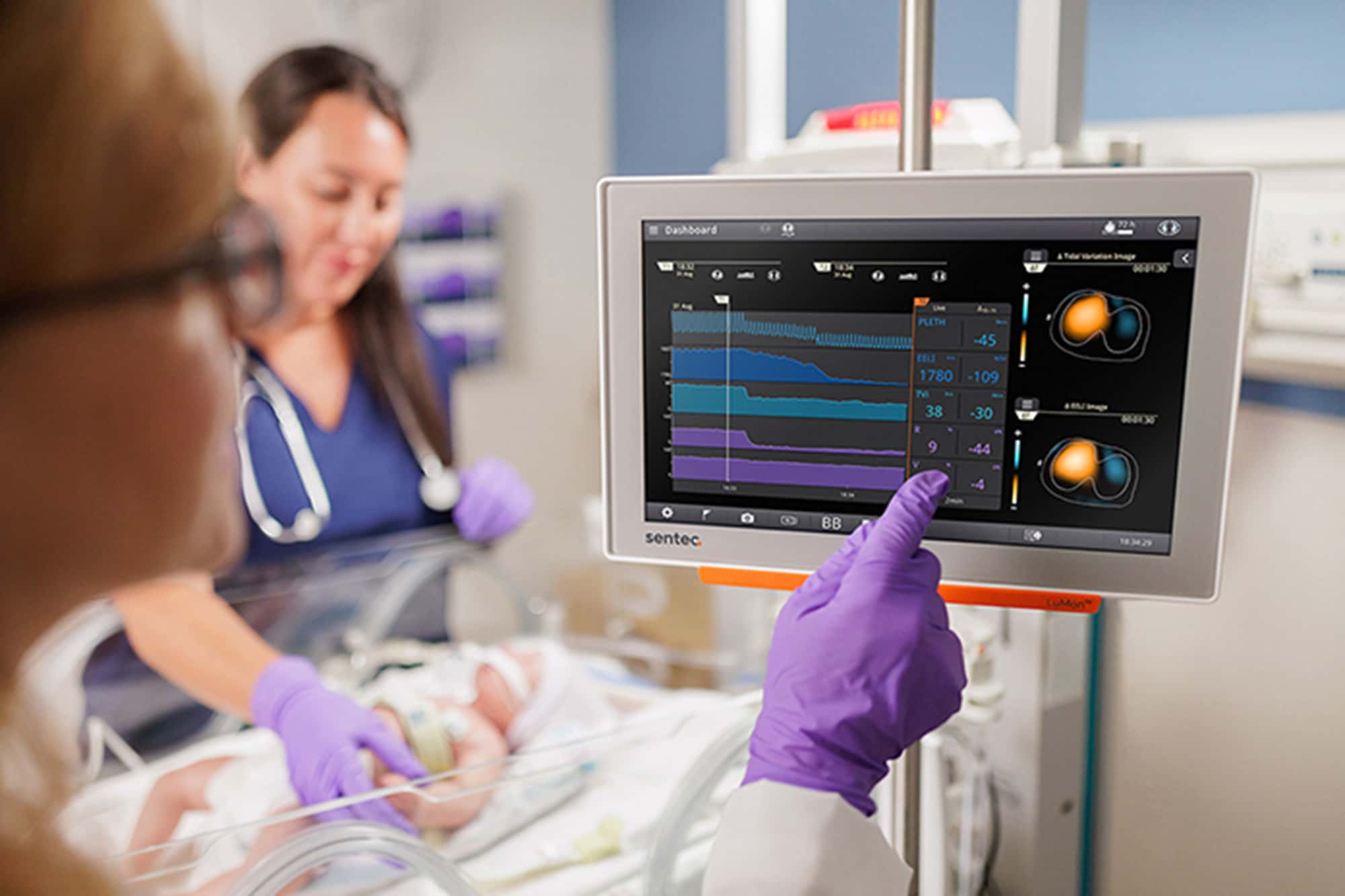 FDA Clears Sentec's LuMon EIT System | RT