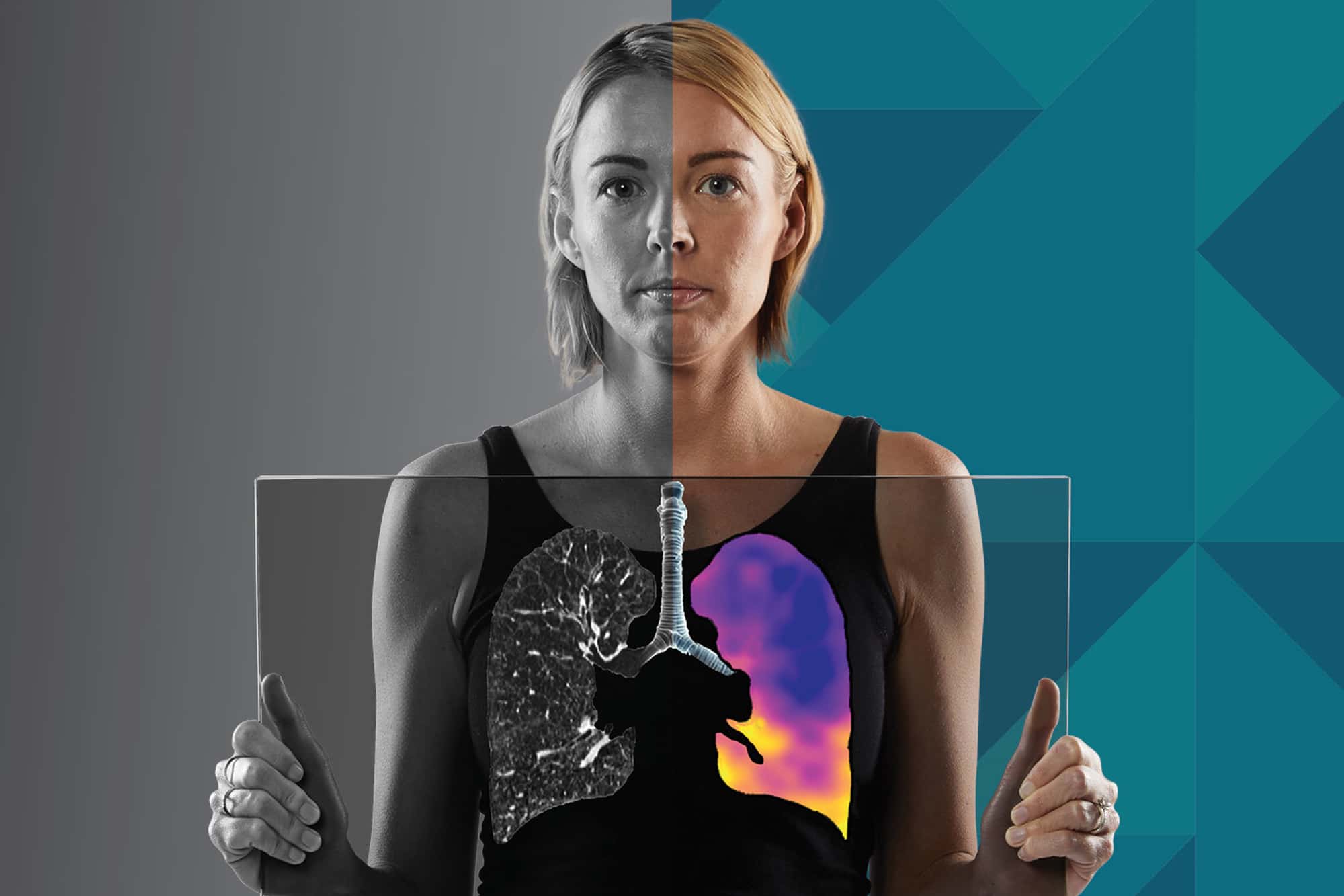 4DMedical to Expand Software-Based Lung Imaging in US | RT