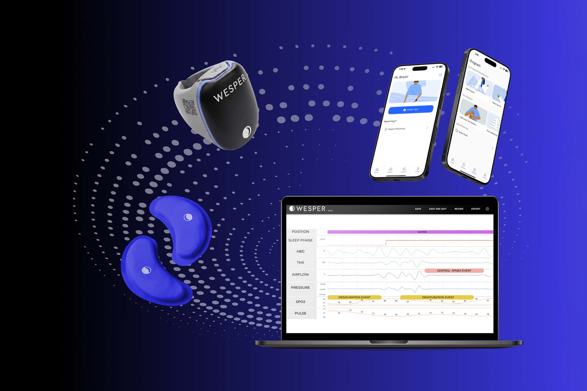 Wesper Launches Multi-tier Home Sleep Testing Platform | RT